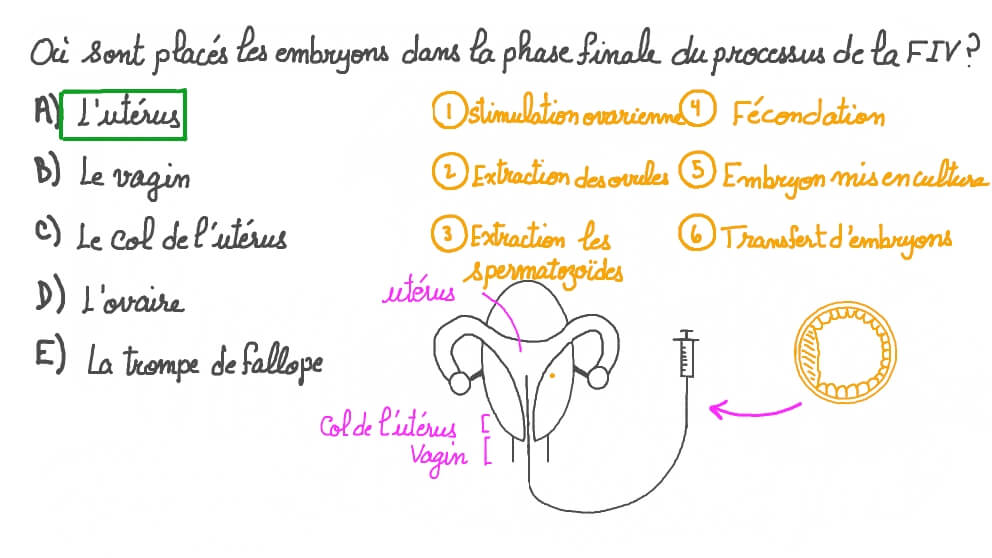 Question Video: Décrire les étapes de la FIV | Nagwa